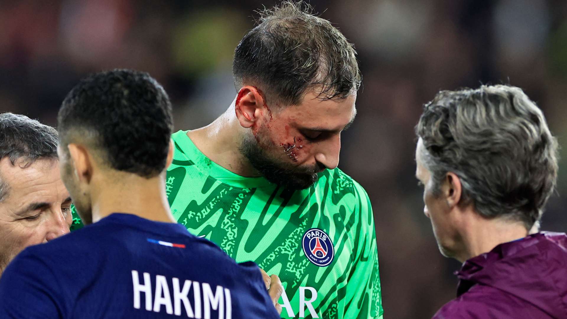 PSG share Donnarumma update after horrific facial injuries